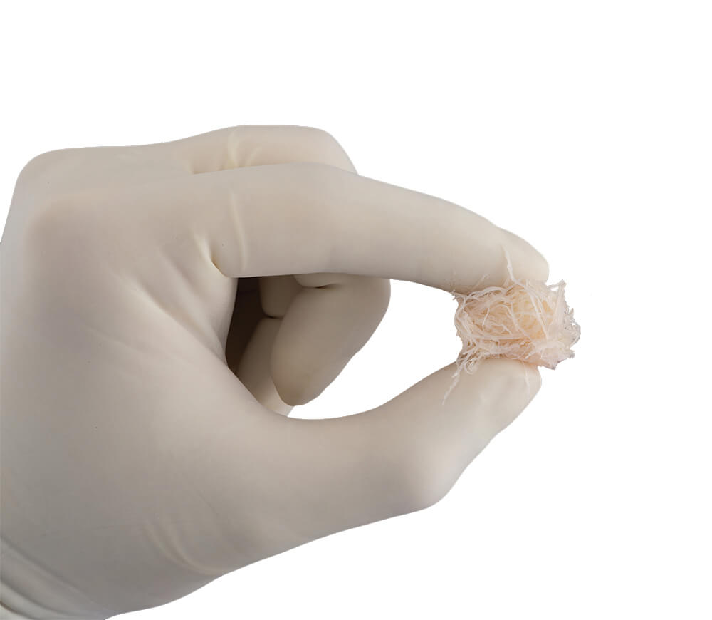 Allovance Xpress Fibres 5cc - Australian Biotechnologies